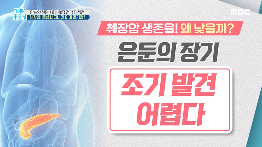 췌장암 증상 나타나면 이미 말기 암